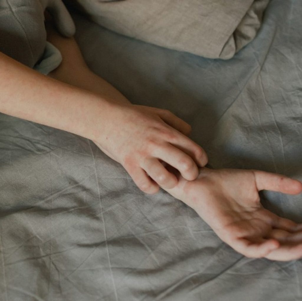 Scabies: transmission, symptoms and prevention - Helsana